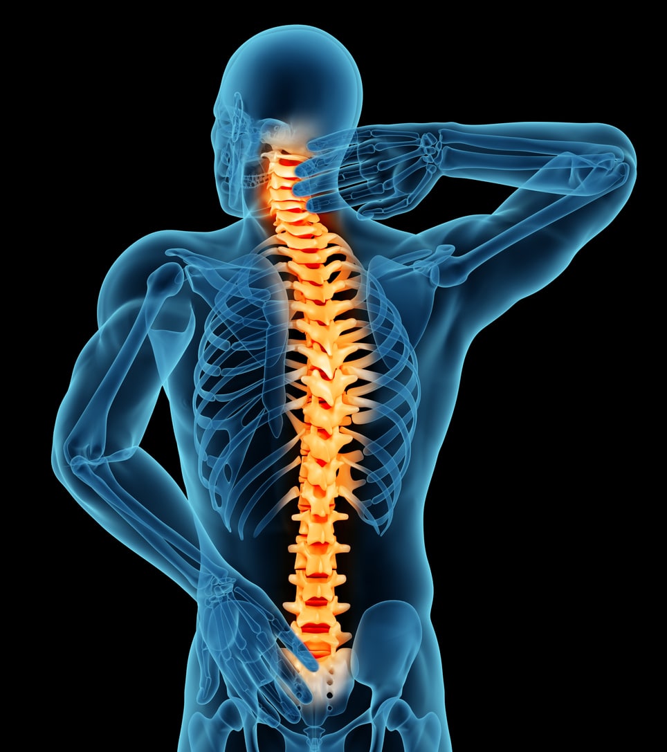 Cervical Myelopathy Procedure New Jersey - Spine Care